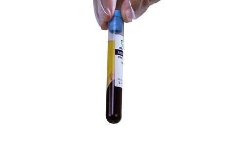 Platelet Rich Plasma Separation PRP kit with ACD Gel