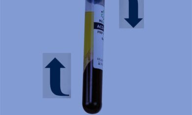 PRP Preparation Procedure | PRP KIT, PRP TUBE, Platelet Rich Plasma ...