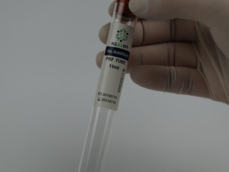 Differences and clinical applications of PRP, APRF, iPRF, CGF | PRP KIT ...